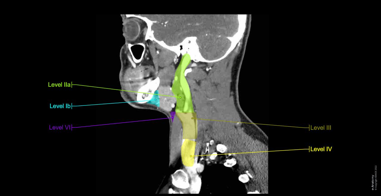 Ct Scan Of Head And Neck Normal Anatomy E Anatomy