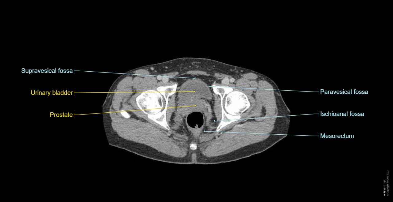 Abdomen And Pelvis Normal Anatomy E Anatomy