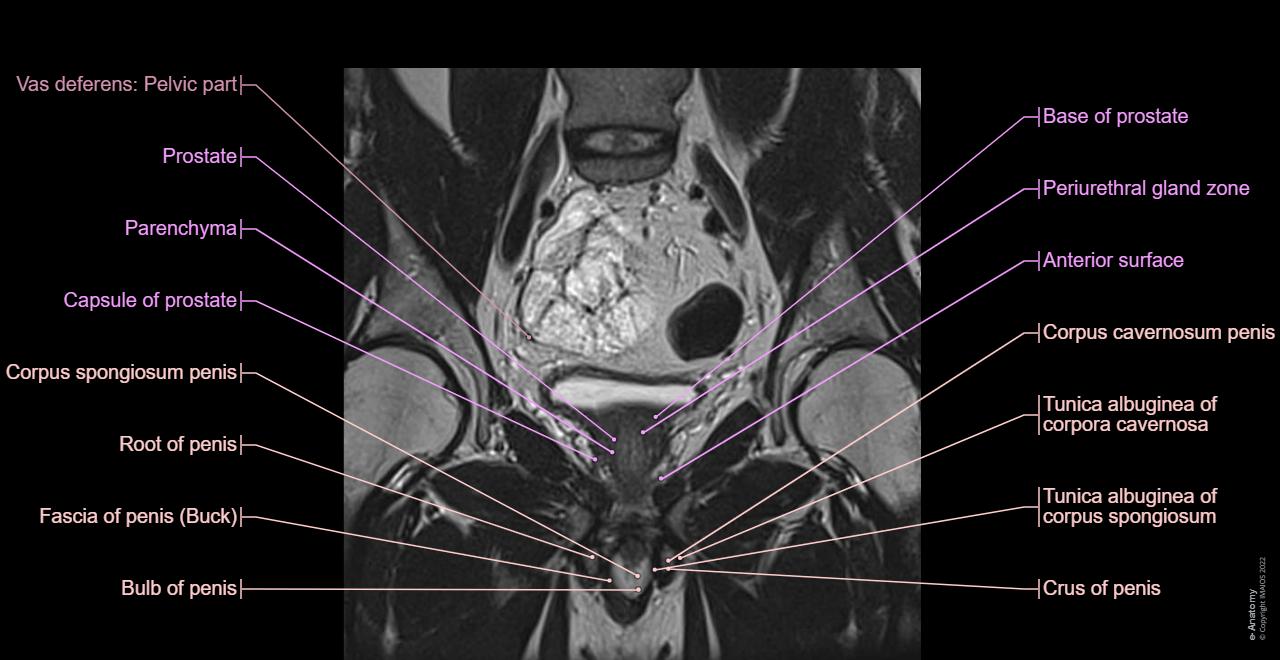 The male pelvis: normal anatomy | e-Anatomy The male pelvis: normal anatomy | e-Anatomy