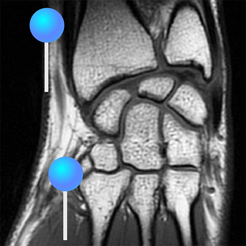 Wrist on 3T MR and 3D pictures: normal anatomy | e-Anatomy Wrist on 3T MR and 3D pictures: normal anatomy | e-Anatomy