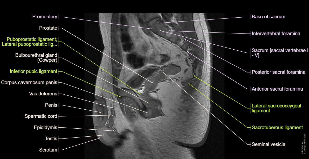Mri Anatomy Of Hip Joint Hip Avascular Necrosis, Osteonecrosis In NYC Mri Anatomy Of Hip Joint Hip Avascular Necrosis, Osteonecrosis In NYC